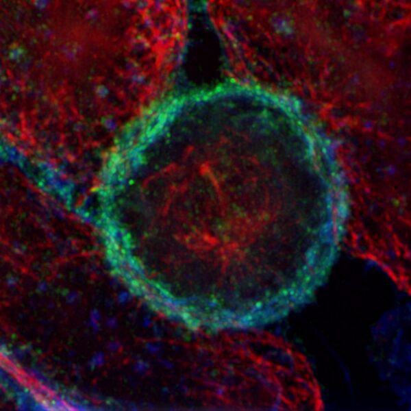 Imaging Calendar Competition winners - The Antibody Society